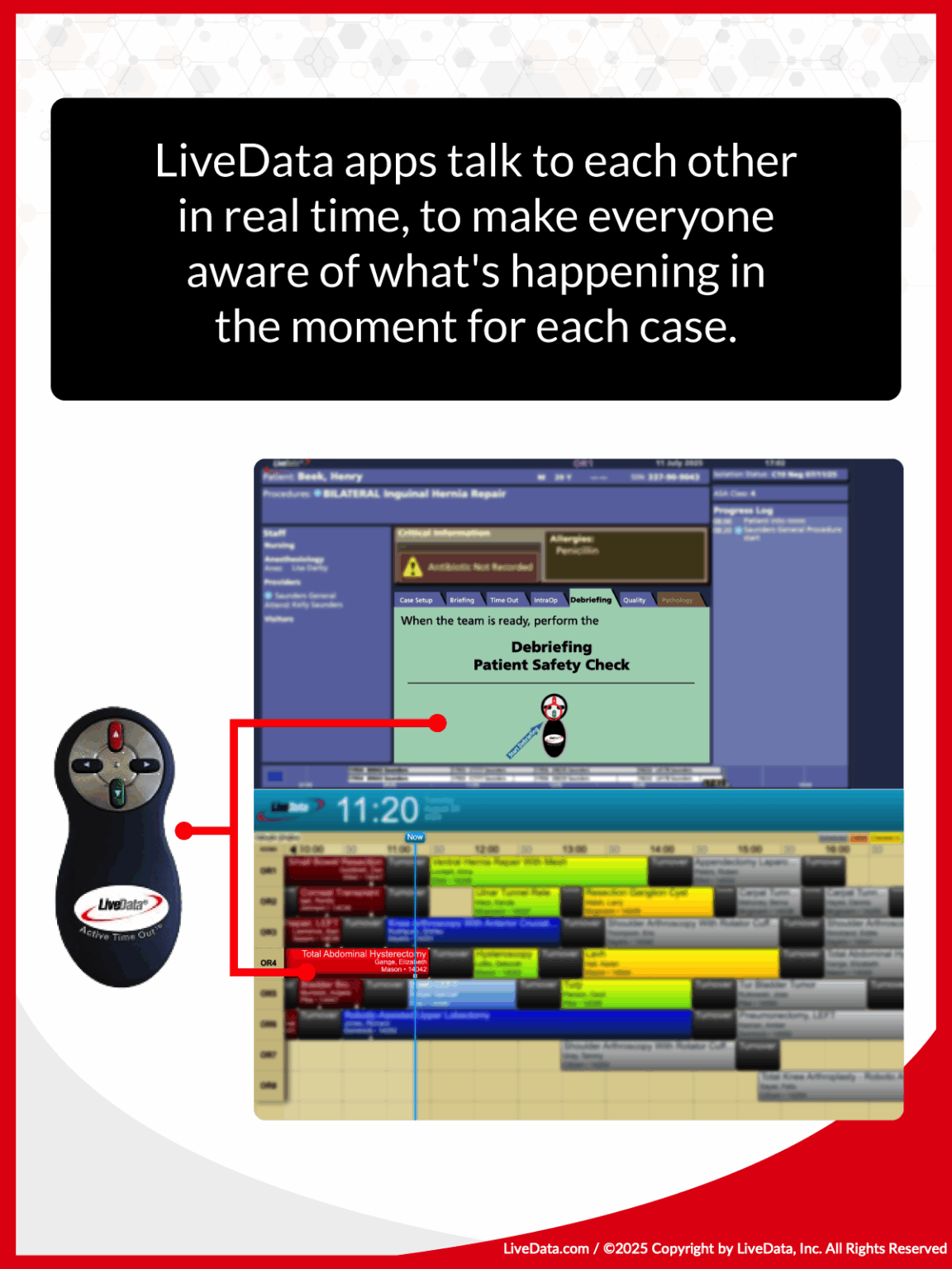 LiveData: The Smart OR Partner Optimizing Surgical Capacity for Hospitals - Hospitalogy